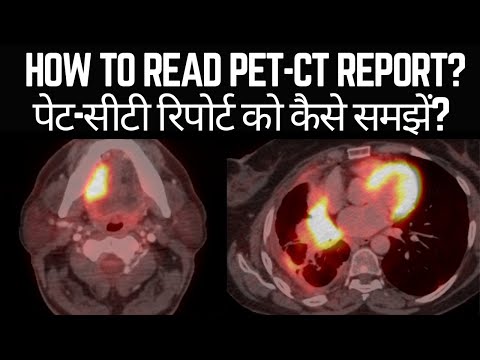 पेट-सीटी रिपोर्ट कैसे समझें? How to read PET-CT report #petctreportkaisesamjhe #petctreportreading