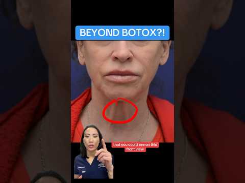 GOODBYE SAGGING NECK?! (BEFORE AFTER) #facelift