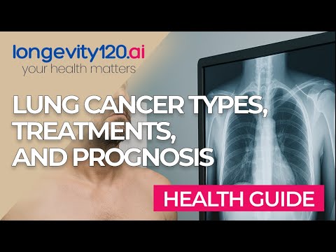 Health Guide for Lung Cancer Types, Treatments, and Prognosis