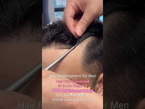 Hair Replacement for Men, #1 in San Diego, Best Price Guaranteed #hairreplacment #hairloss