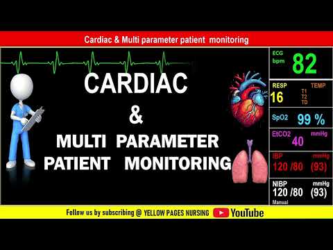 Cardiac & Multi parameter patient monitoring in ICU | Nursing Considerations
