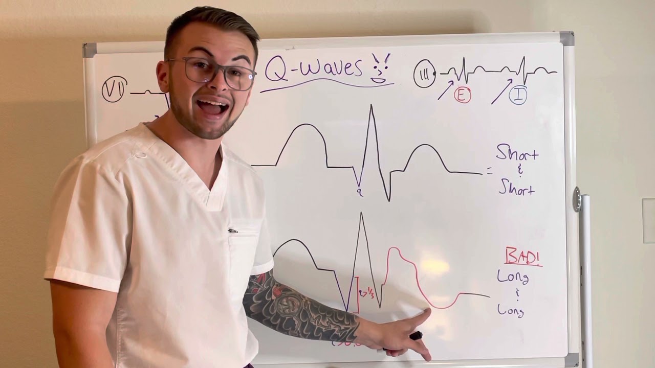 EKG Series: Q Waves (Respiratory Variation and Pathological Q Waves)