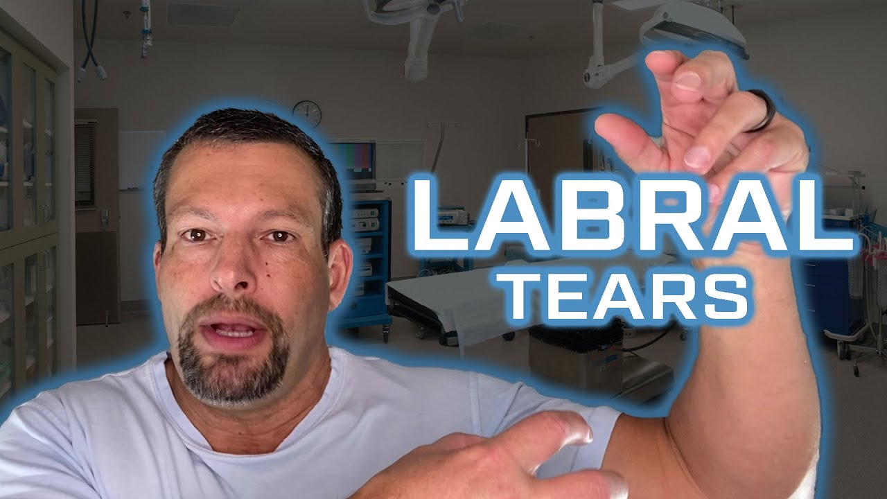 What is a Posterior Labral Tear and How Do I Know If I Have One?