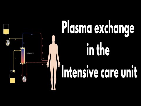 Plasma exchange in the intensive care unit