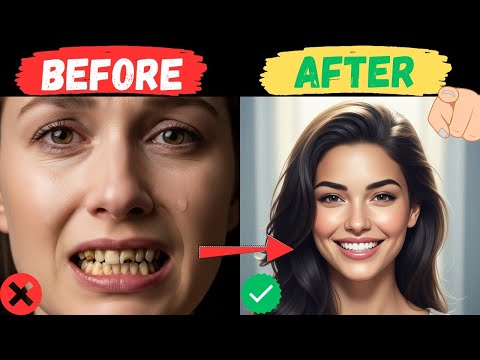 Teeth Whitening Tips Instant Results | Oral Care | Dental Health | Dental Care | Dental Routine