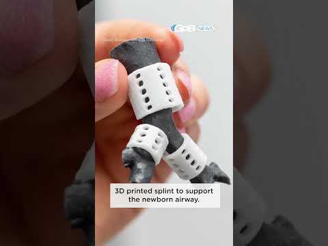 Georgia Tech’s 3D printer helps a Georgia girl breathe on her own