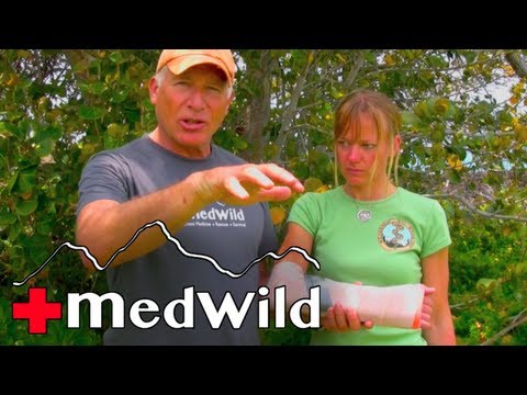 How to use a SAM Splint (Forearm) | Wilderness Medicine