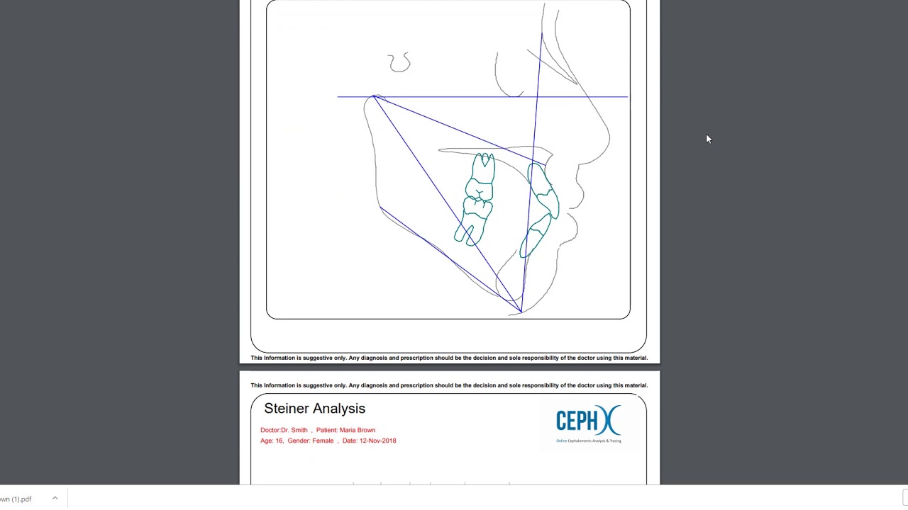 CephX | Downloading Cephalometric Analysis