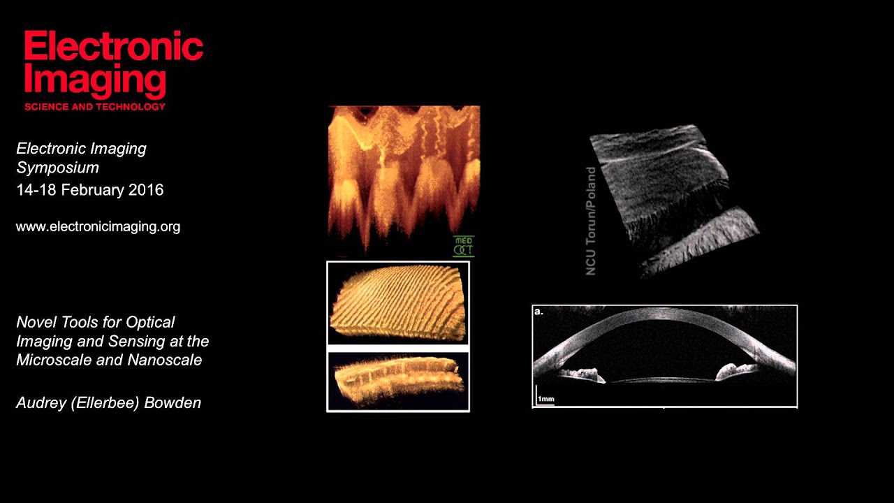 EI 2016 Plenary: Novel Tools for Optical Imaging and Sensing at the Microscale and Nanoscale