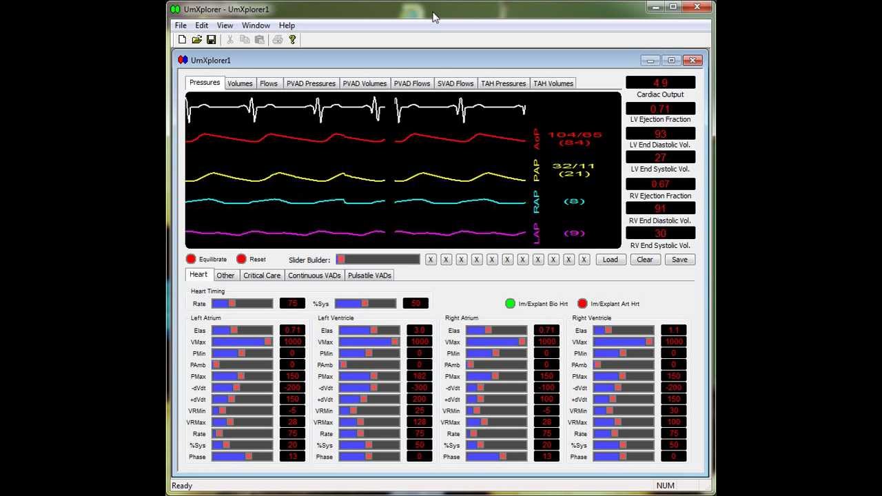 Hemodynamics simulation using UmXplorer