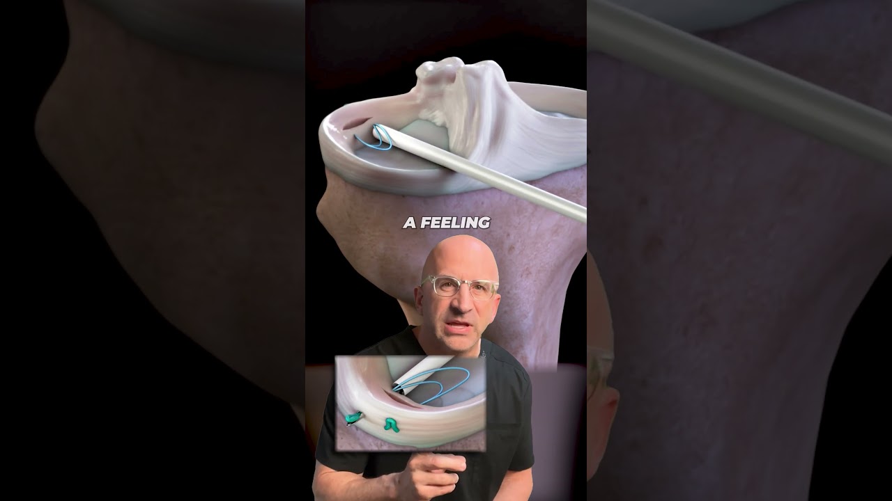 How Does It Feel to Tear Your Meniscus: Top #MeniscusInjury Signs