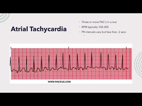 ECG for PTs