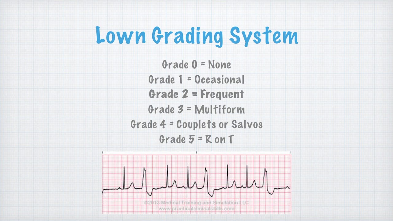 AEMT Ventricular Rhythms