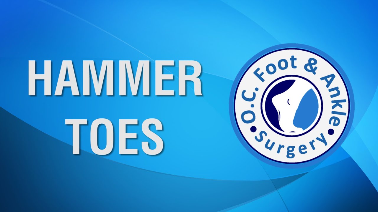 Hammer Toe Surgery by Dr Matt Ahmadi at Orange County Foot and Ankle