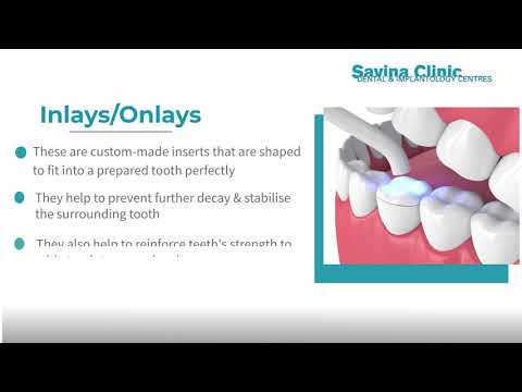 Cosmetic Dentistry Frequently Asked Questions Savina Dental Clinics (Malta & Gozo)