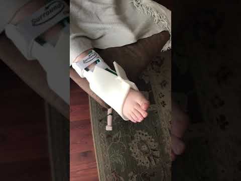 Buck’s Traction Device
