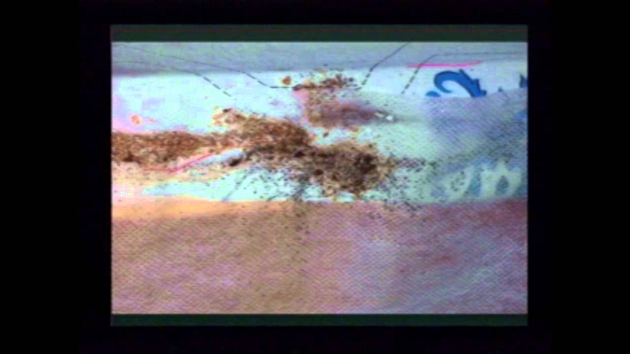 Let's Beat the Bug!-Bed Bug Basics