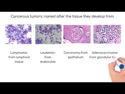Pathophysiology: Benign and Cancerous Tumors