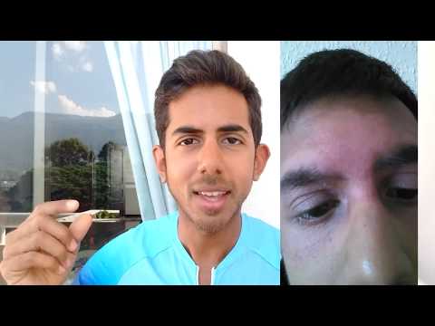 Topical Steroid Withdrawal | TSW [RANT]