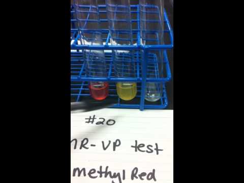 MR-VP Test
