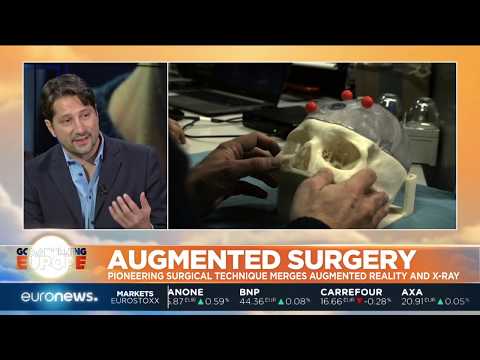 Pioneering surgical technqie merges Augmented Reality and X-Ray | #GME