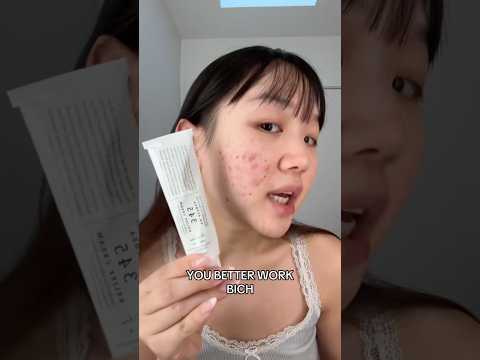 Is 345 cream worth it? 🥴YesStyle code: GRACE888 to get $$ off 🙂↕️#skincare #kbeauty #acne