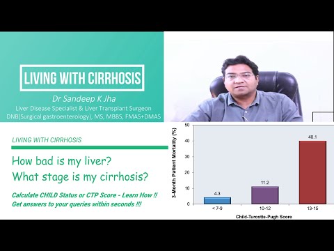Calculate your CTP Score & CHILD status