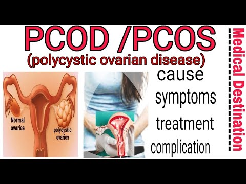 PCOD or PCOS in hindi | Medical destination |