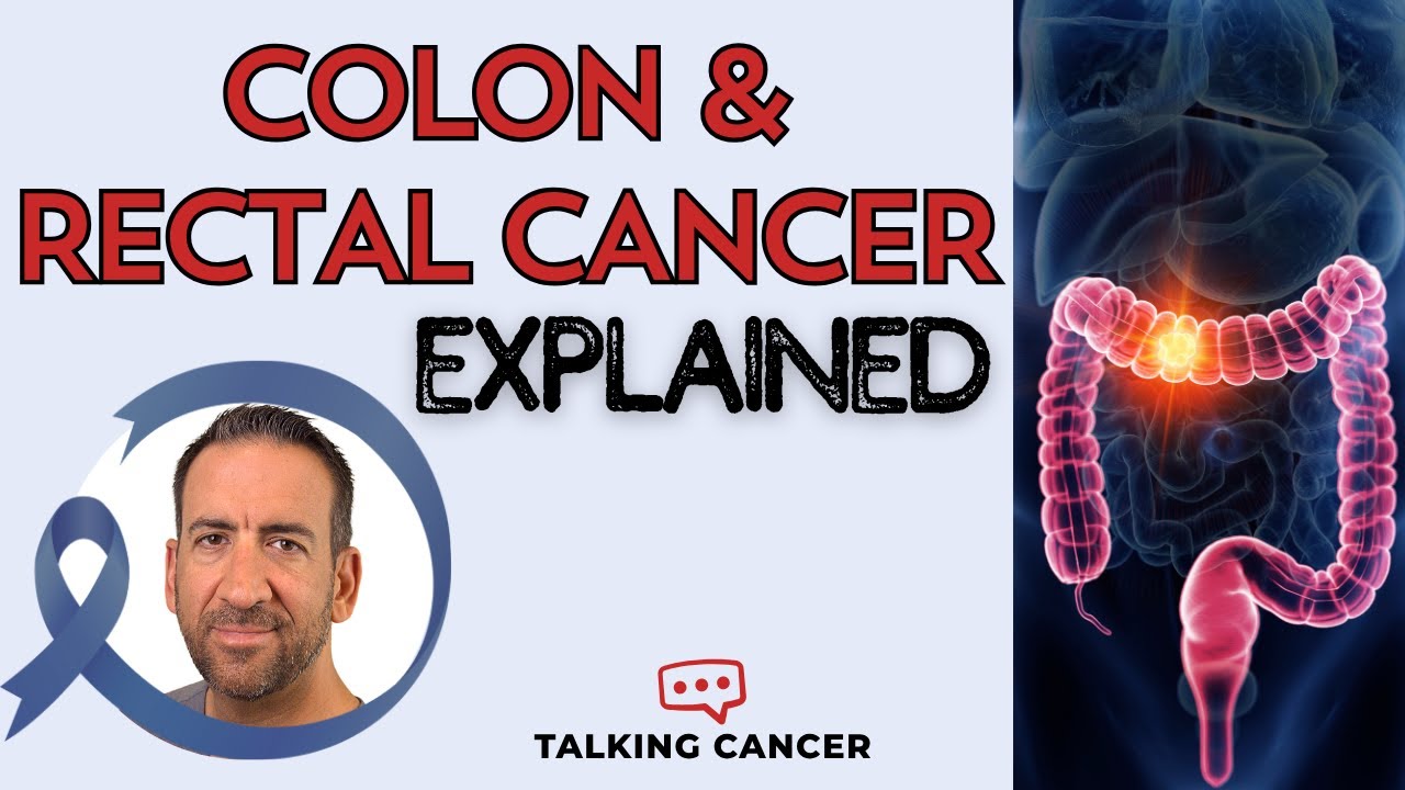 Colon Cancer and Rectal Cancer: EXPLAINED