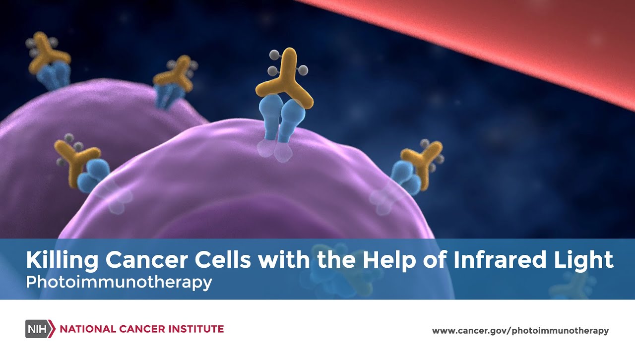 Killing Cancer Cells with the Help of Infrared Light - Photoimmunotherapy