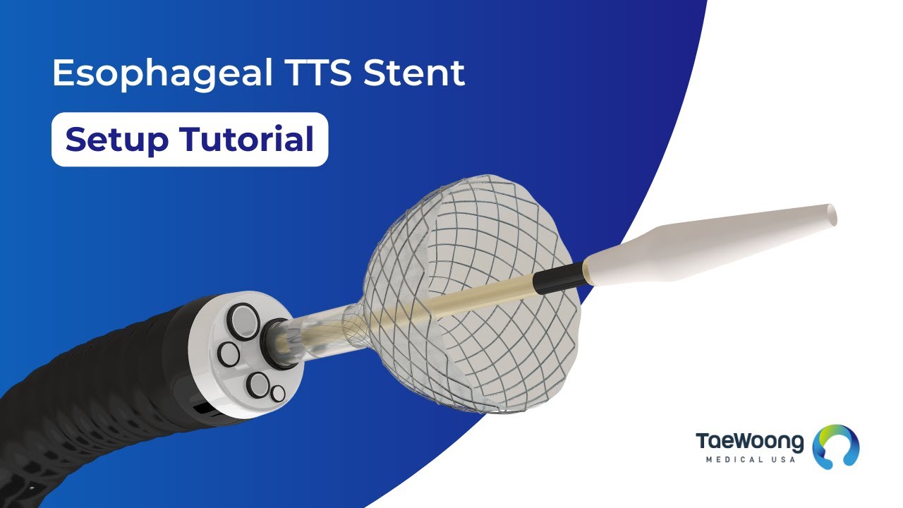 TaeWoong Esophageal Through the Scope (TTS) Stent Setup