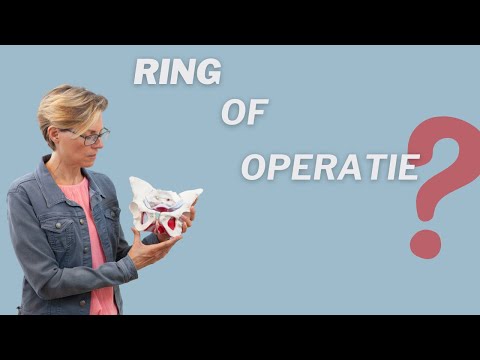 Wanneer kies je voor een ring of operatie als je een verzakking hebt?