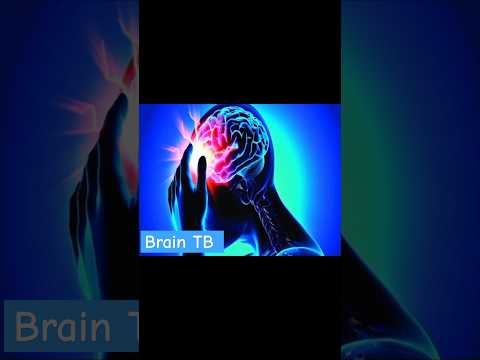 What is Brain TB