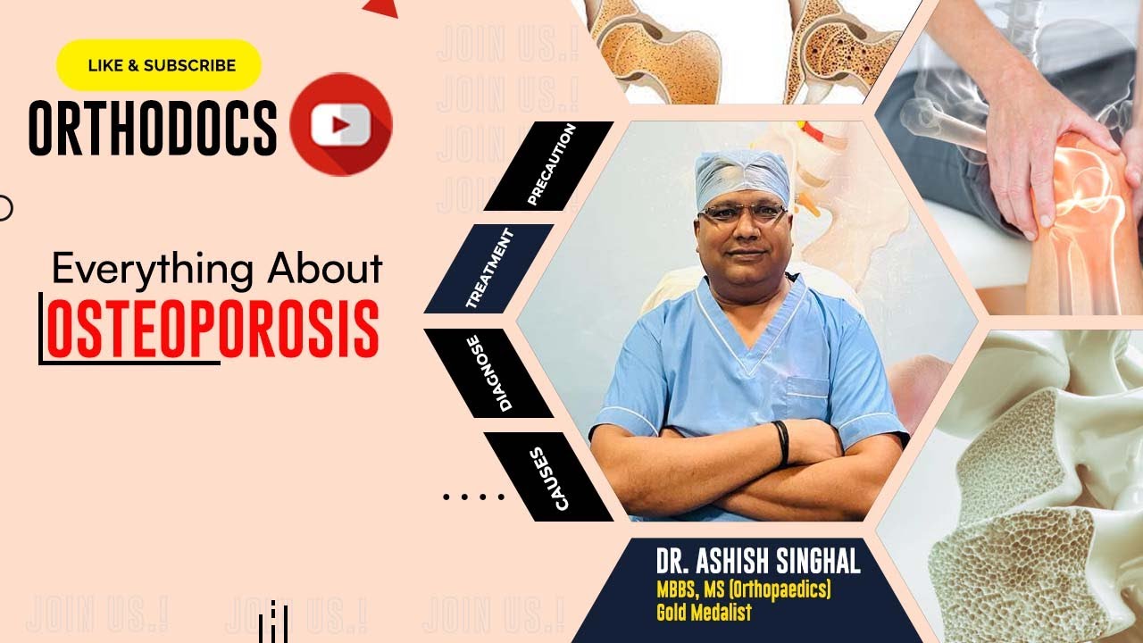 Understanding Osteoporosis: Causes, Symptoms, and Treatment | Comprehensive Guide