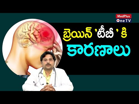 Brain TB Causes and Treatment | Dr.Murali Krishna | @MedPlusONETV