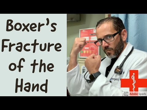 Boxers Fracture - patient education video