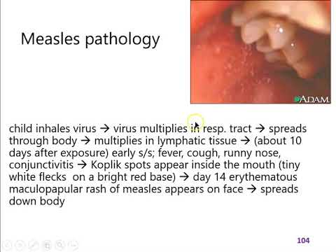 Lecture 12 part 7: measles mumps rubella