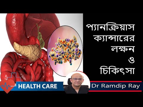 6 Warning Signs of Pancreatic Cancer || অগ্ন্যাশয় ক্যান্সারের লক্ষণ || Dr. Ramdip Ray