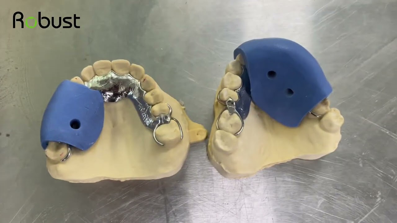 Acrylic processing for cast partial dentures