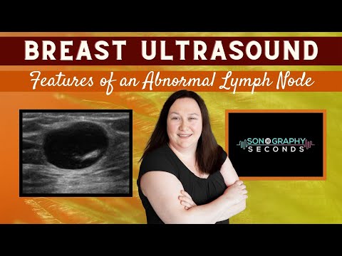 Breast Ultrasound (Features of an Abnormal Lymph Node)
