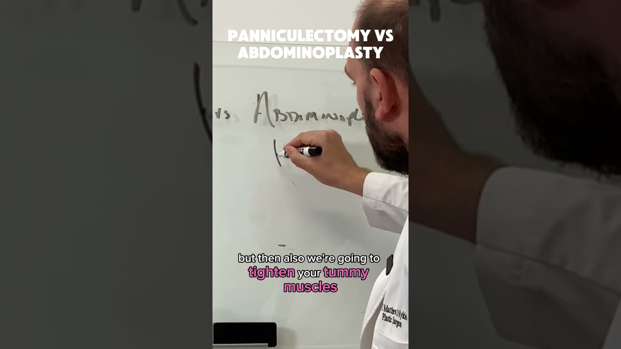 Panniculectomy vs. Abdominoplasty: What’s the Difference?
