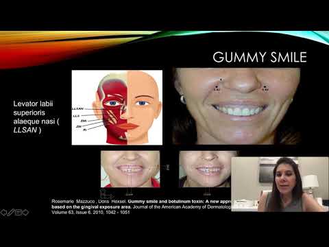 Panfacial #Botox Techniques