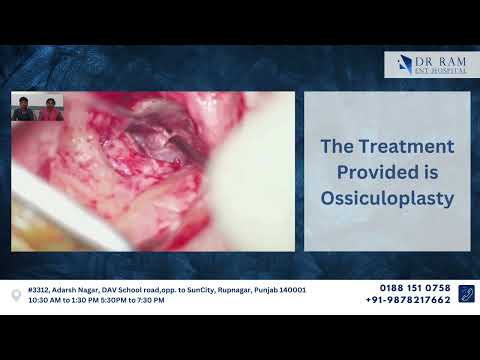 Transform Your Hearing with Dr. Ram ENT Hospital: Ossiculoplasty