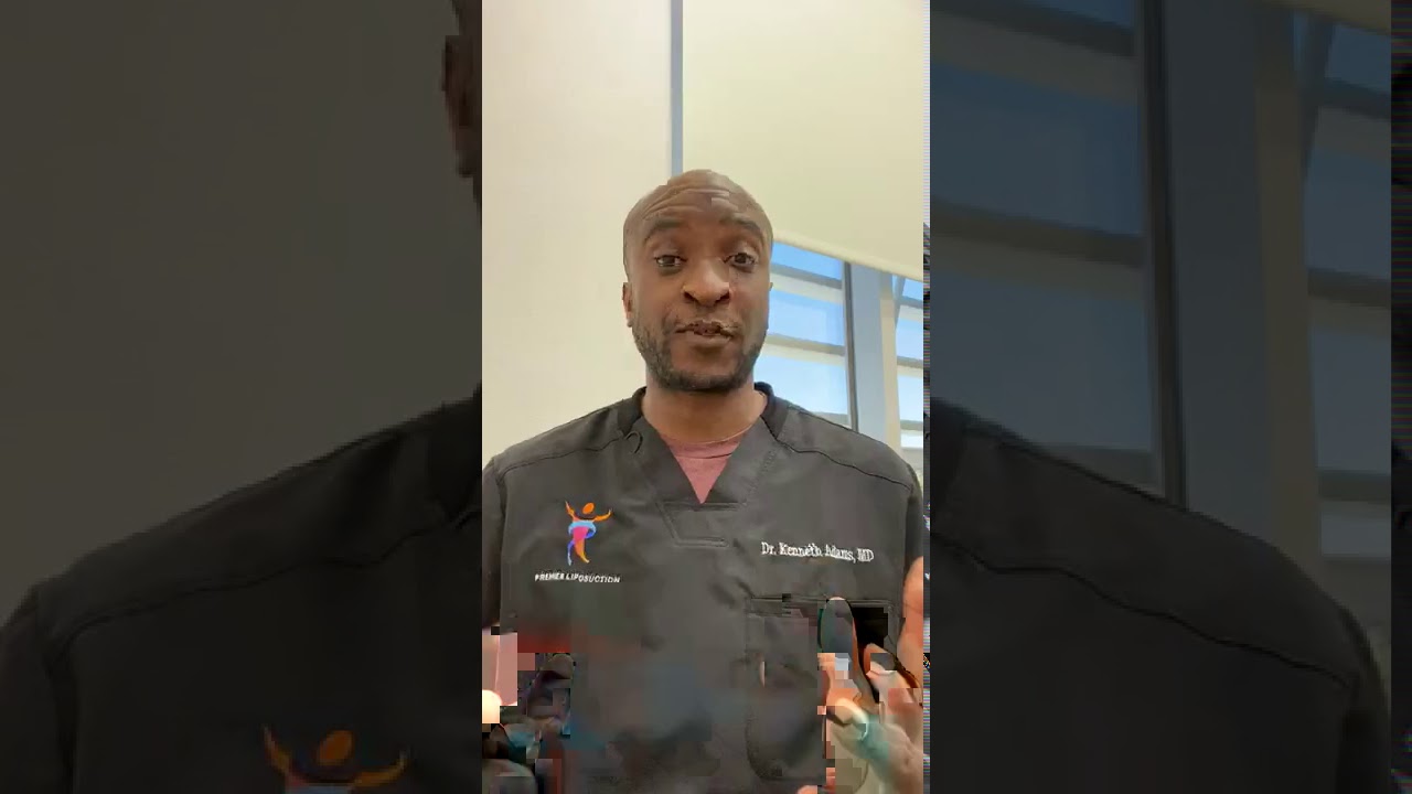 Fat Transfer to Buttocks or Breasts | Dr. Adams | Premier Liposuction