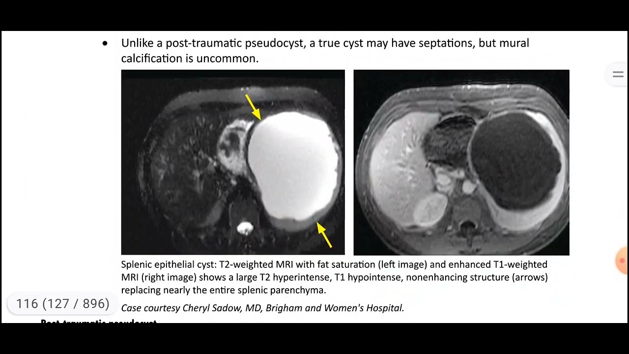 GIT PART 2 CORE RADIOLOGY PDF TO VIDEO
