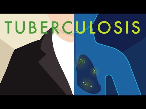 Tuberculosis Explained