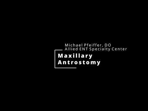 Maxillary Antrostomy