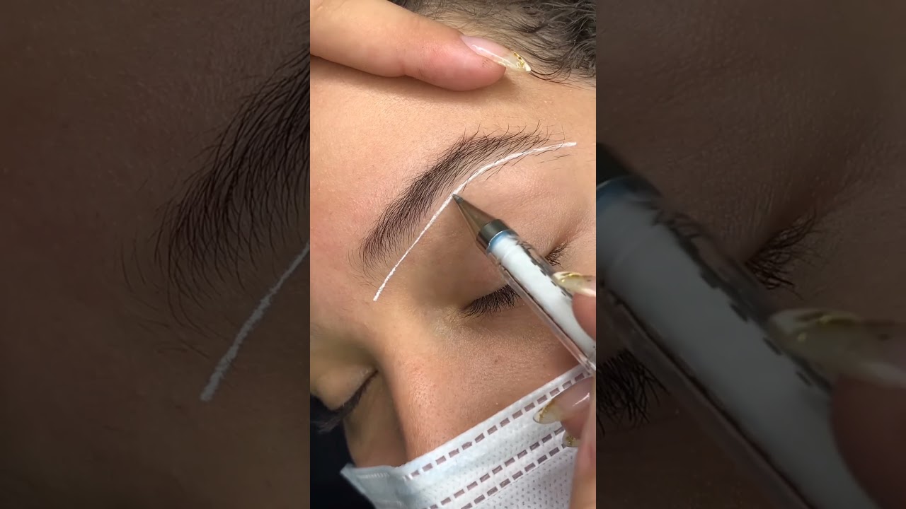 Marcação com caneta em gel