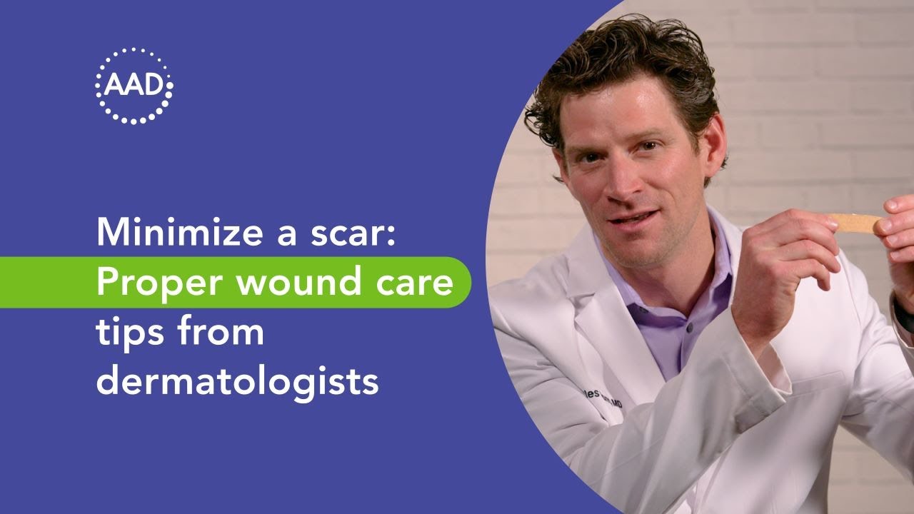 Minimize a scar: Proper wound care tips from dermatologists