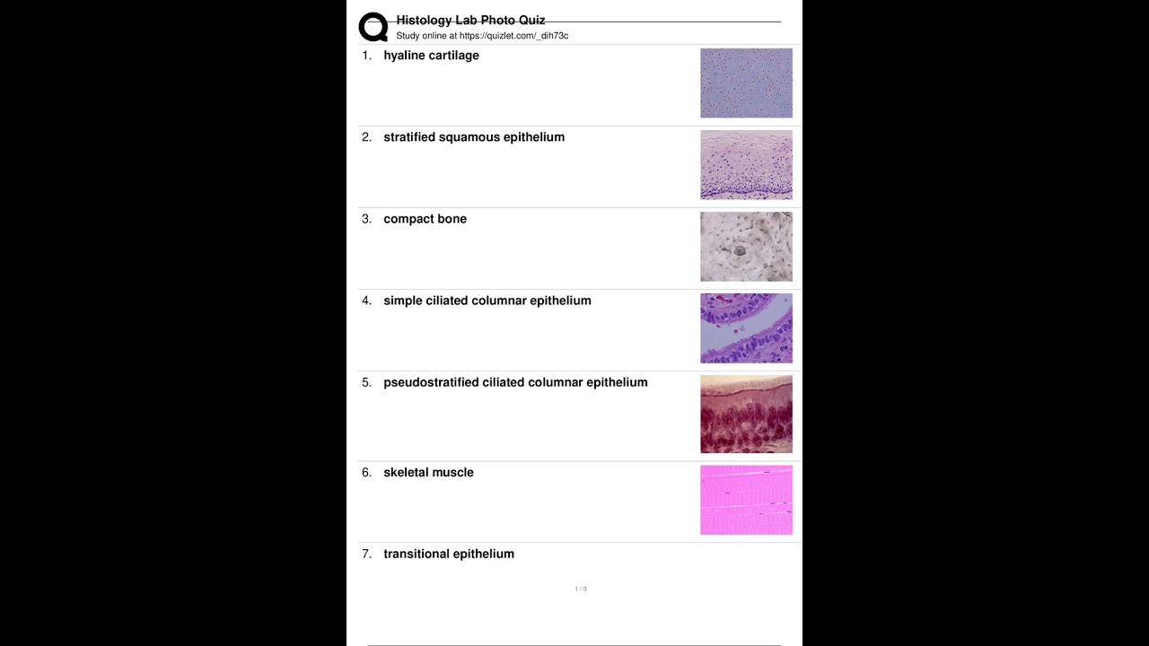 Histology Lab Photo Quiz Flashcards